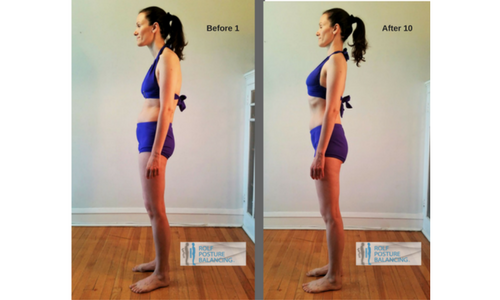 Rolf Method Structural Integration Before and After 10 Series Pictures Philip Clampitt
